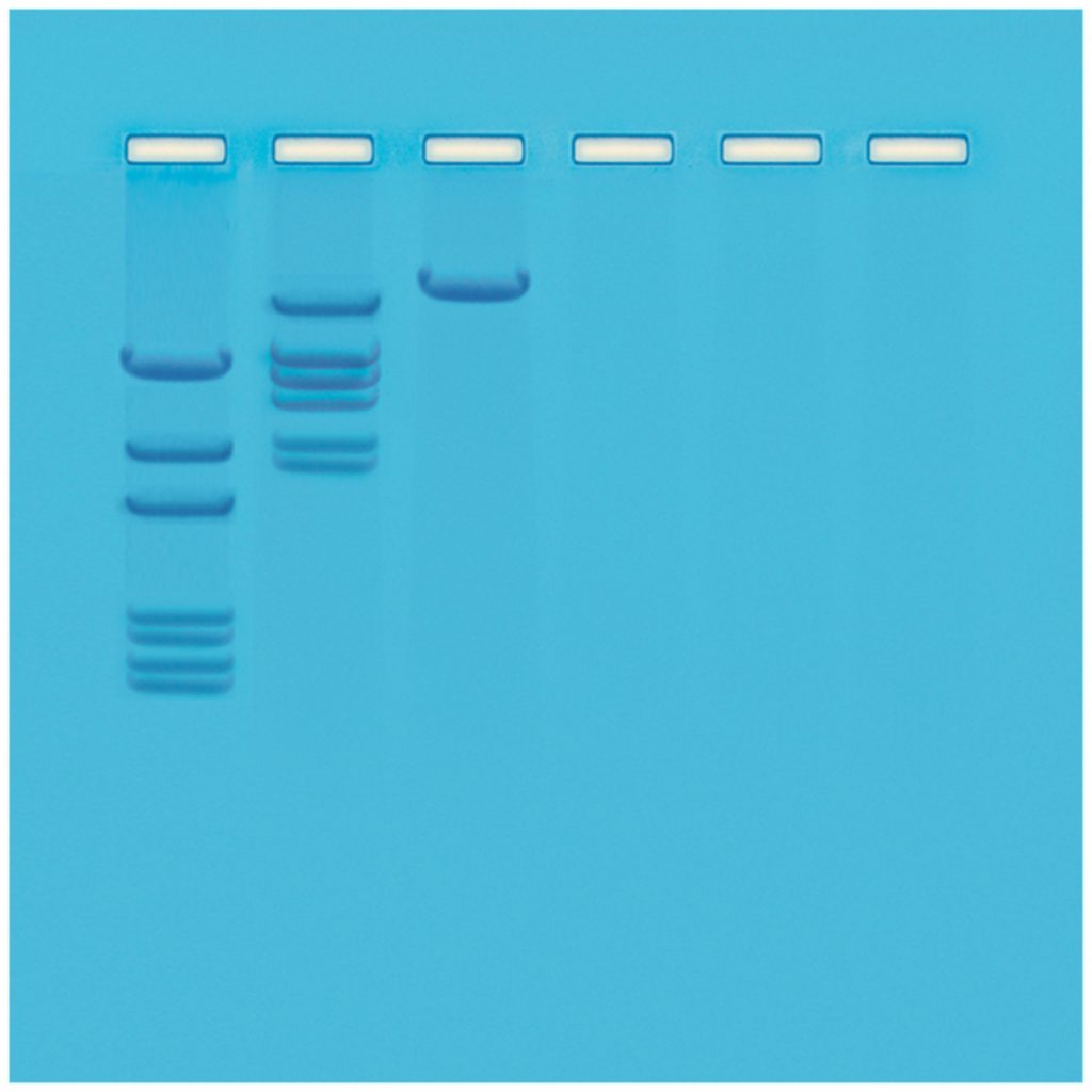 Classroom Kit - Cleavage of Lambda DNA with EcoRI Restriction Enzyme ...